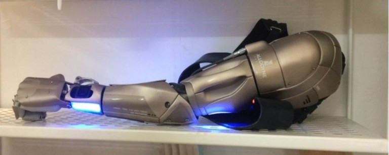 This is what a Metal Gear inspired prosthetic arm looks like - Metal ...
